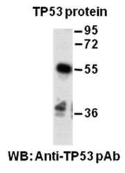TP53 pAb - NewEast Biosciences - GTPase and Oncogene